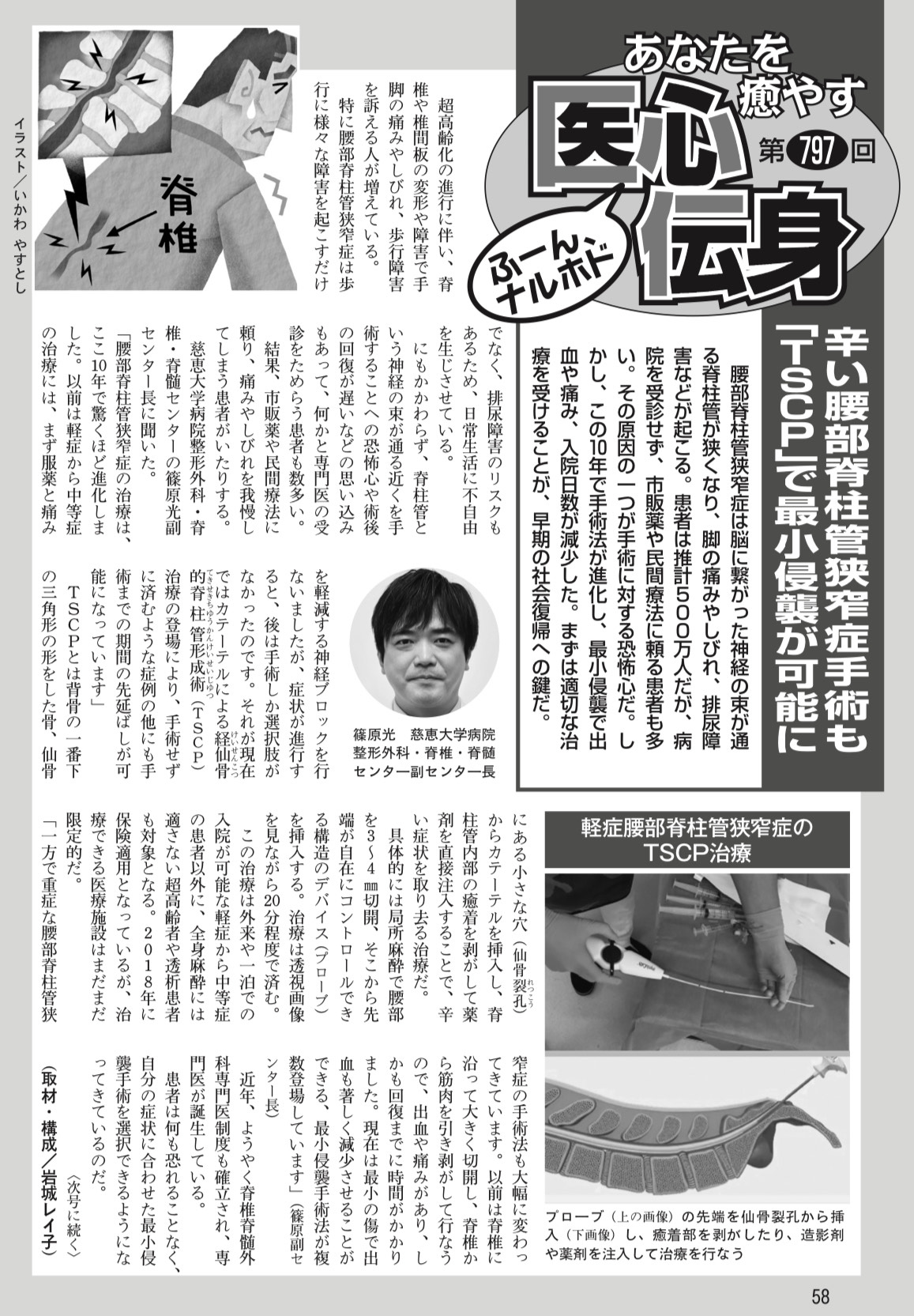 【脊椎脊髄外科】篠原先生が週刊ポストの医療コラム「医心伝身（第797回）」で紹介されました。 | 世田谷人工関節・脊椎クリニック